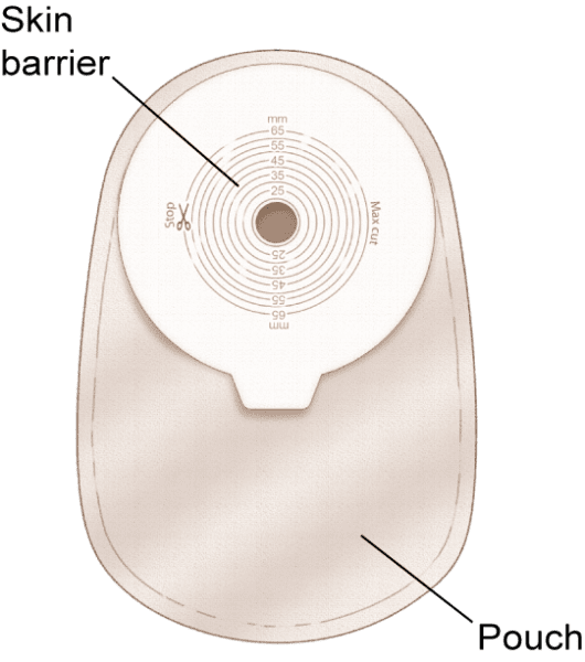 Ostomy Product & Supply Information l United Ostomy Associations of America