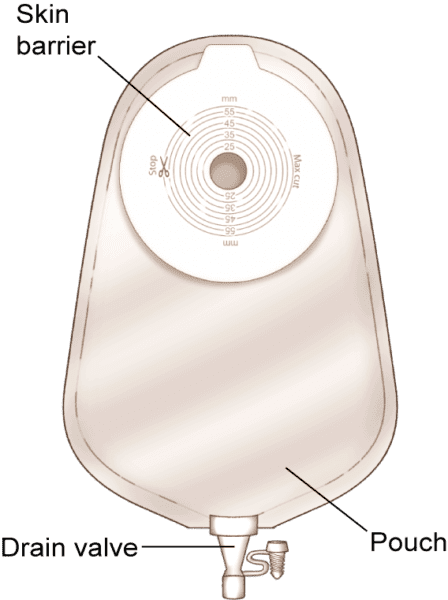 Types of Pouching Systems l United Ostomy Association Of America