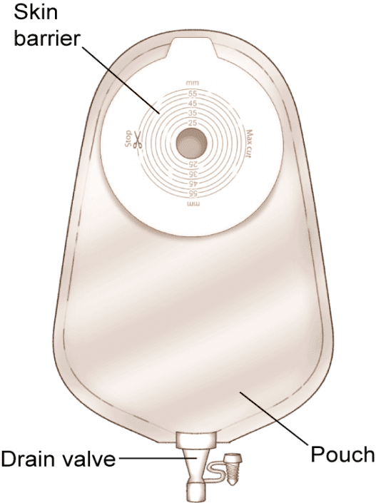 Types of Pouching Systems l United Ostomy Association Of America