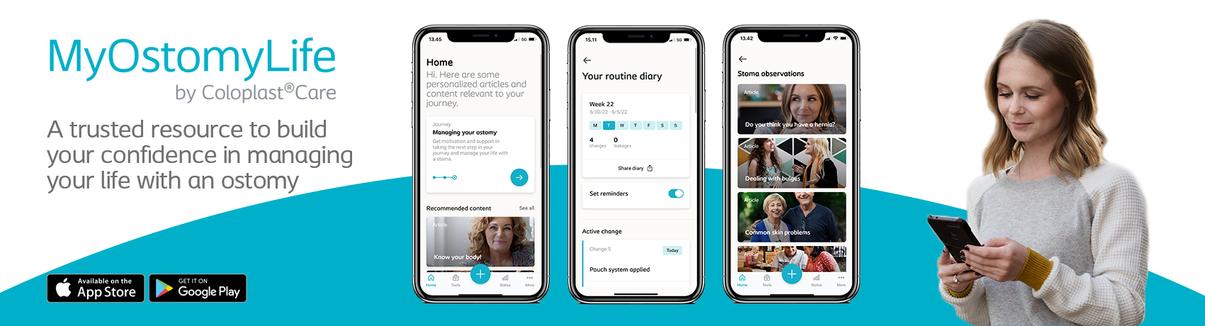 My Life with an Ostomy- Josh - United Ostomy Associations of America