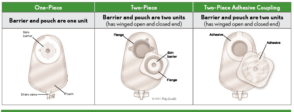 Urostomy Archives - United Ostomy Associations of America