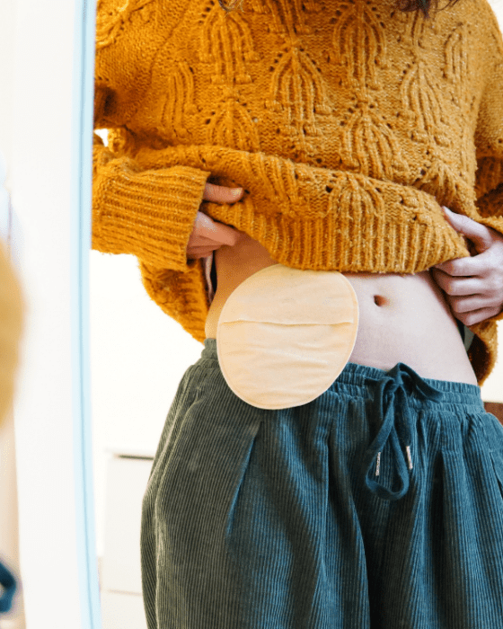 Temporary Ostomy - United Ostomy Associations of America