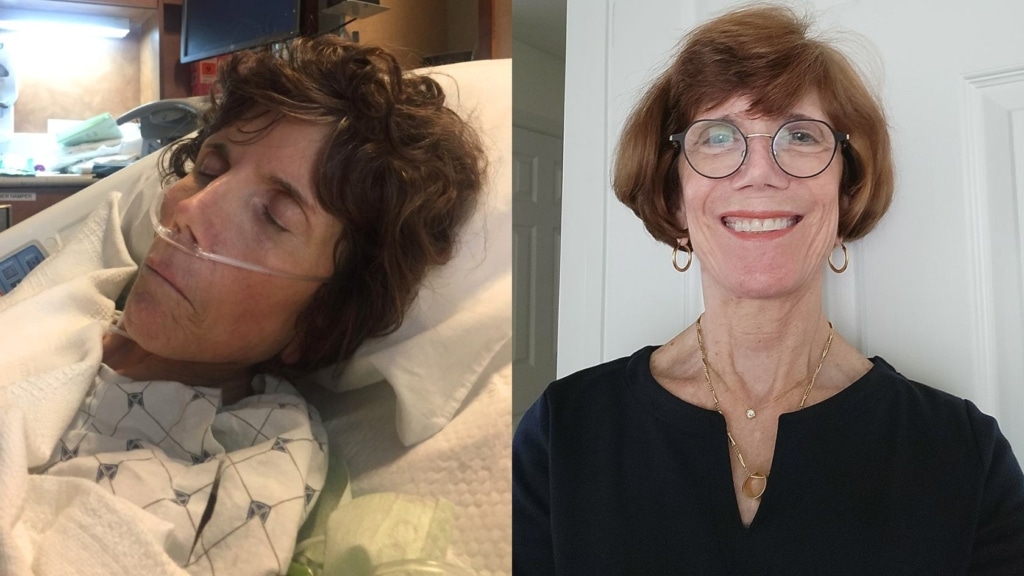 United Ostomy Associations of America l Support, Advocacy, Empowerment